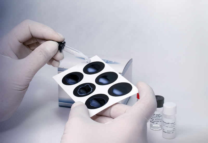 Cepa – MBiolog Diagnósticos